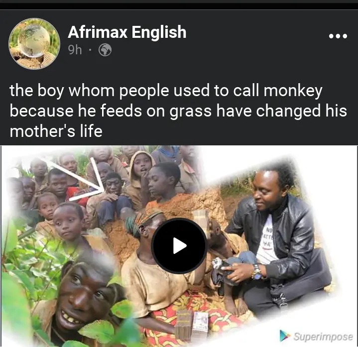 How The Lifestyle Of The Boy Who Was Called ‘Monkey’ Has Changed After ...