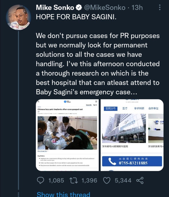 hope-for-sagini-mike-sonko-to-pay-for-eye-implant-for-baby-whose-eyes