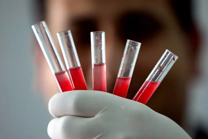 A Brief Analysis Of The Most Expensive Blood Type In The World. – Nicki ...